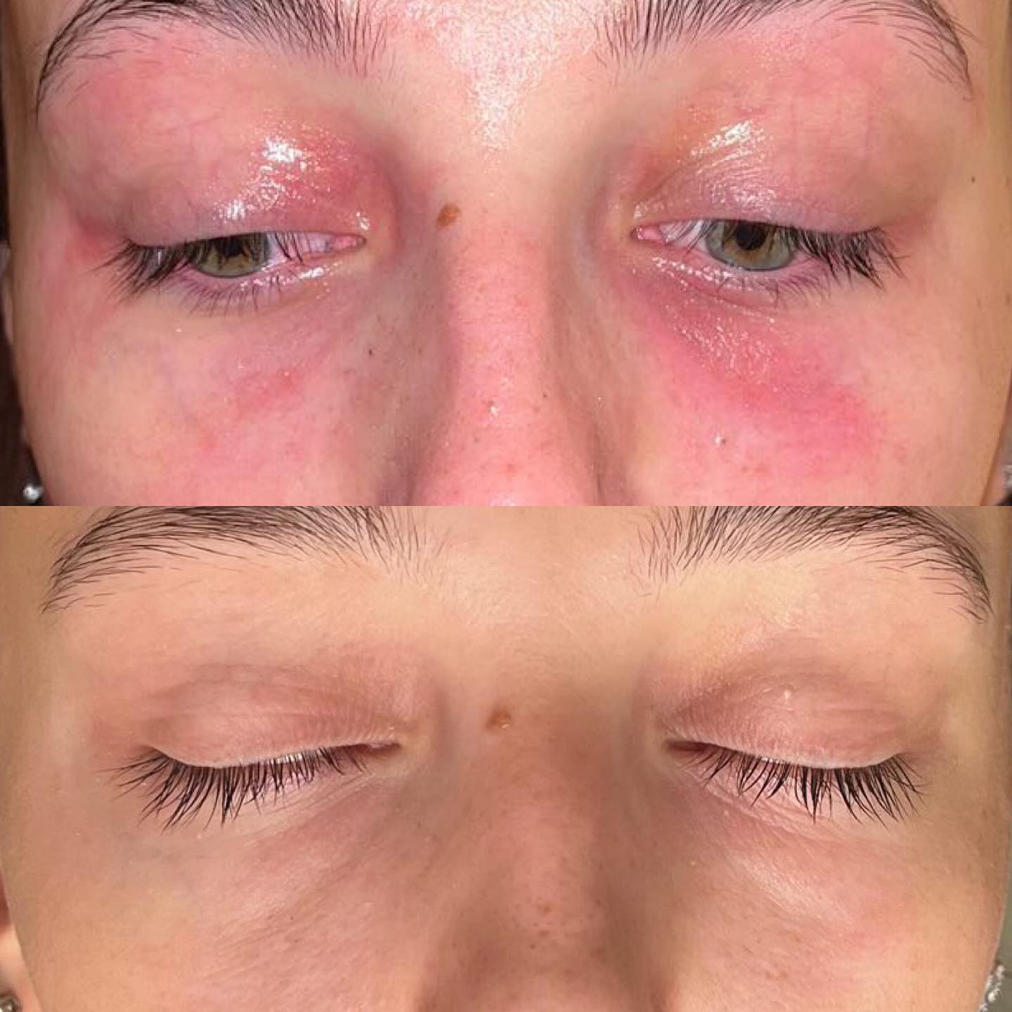 Transformations – Skin Love Clinic